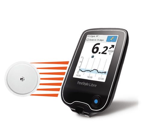 Libre Calibration and Accuracy | Diabettech - Diabetes and Technology