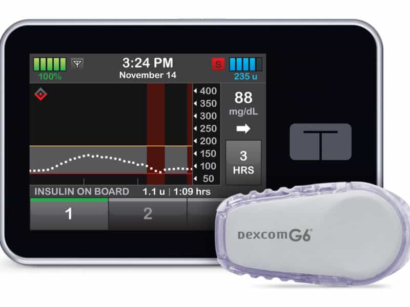 Control-IQ - What we know so far | Diabettech - Diabetes and Technology