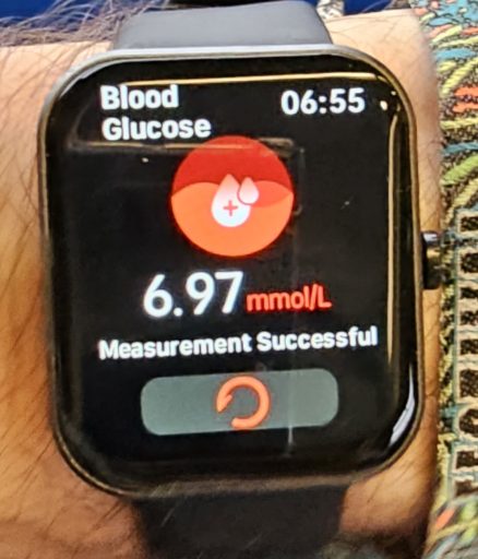 Non-invasive CGM watches. Is this a Dreamcatcher moment? | Diabettech ...