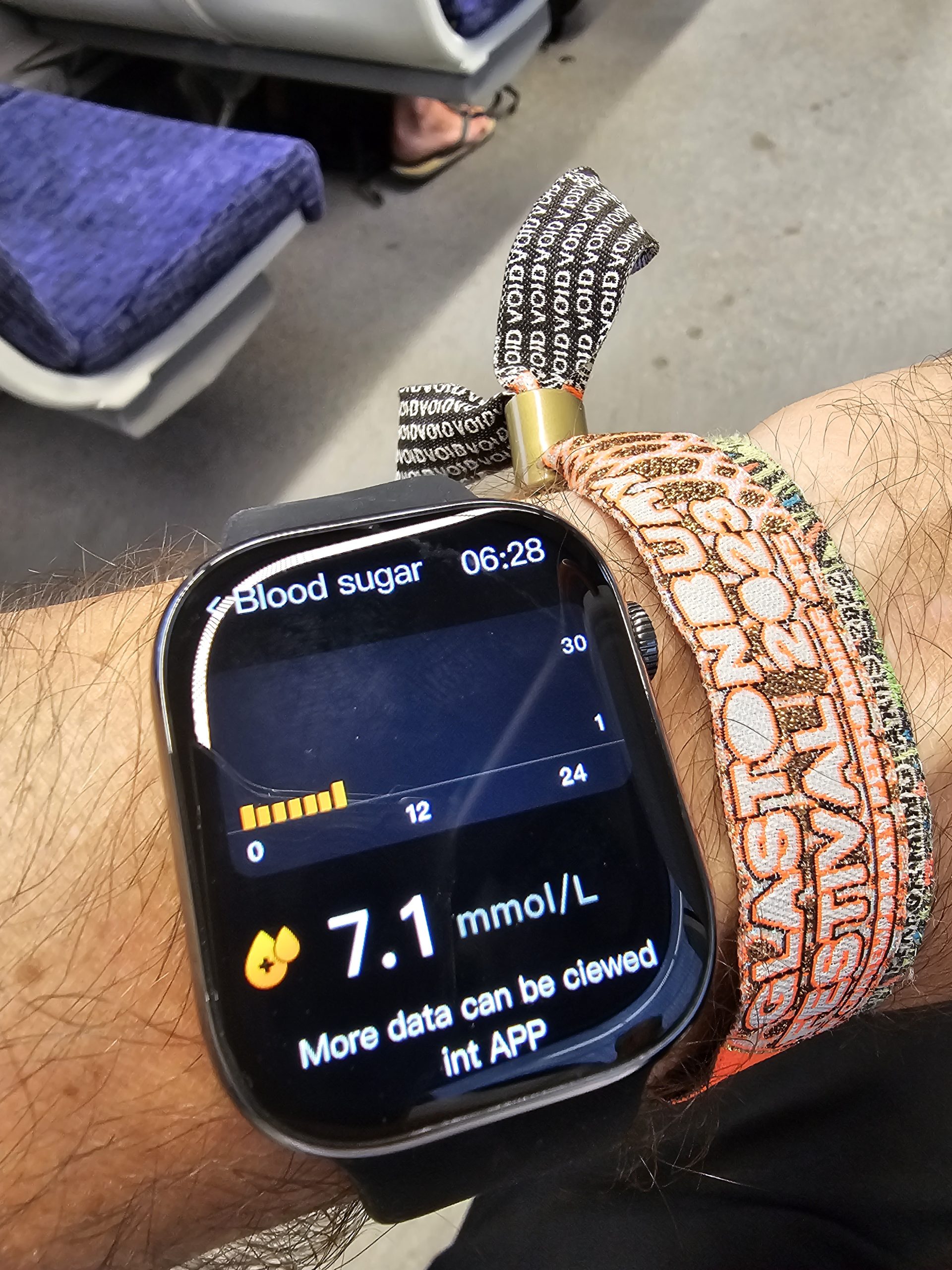 And another one? The final poor CGM Smartwatch | Diabettech - Diabetes ...